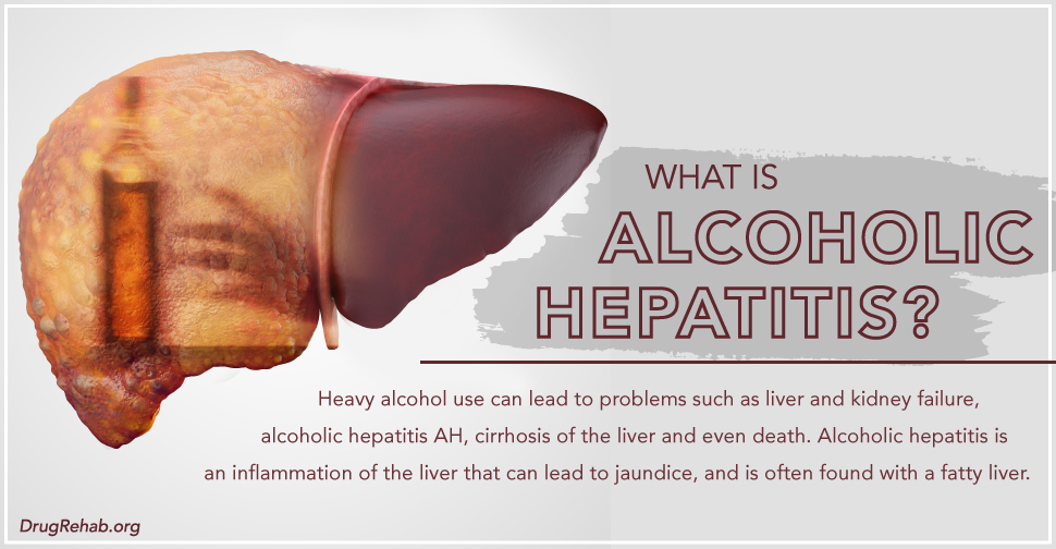What is Alcoholic Hepatitis? | DrugRehab.org